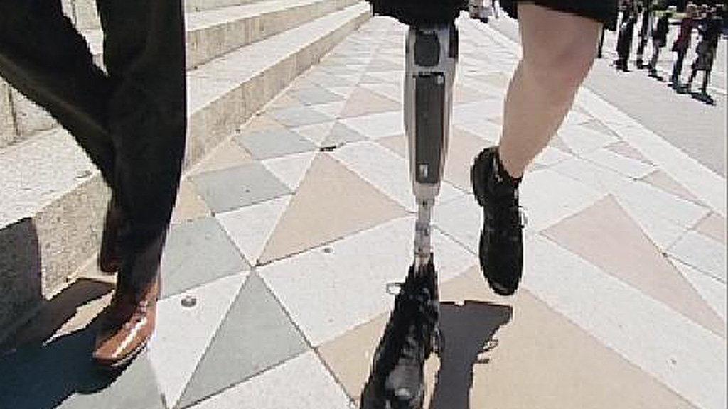 Bionic Power Knee offers new hope to amputees – Channel 4 News