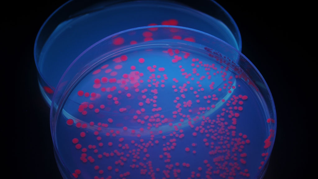Are bugs to blame for obesity? – Channel 4 News