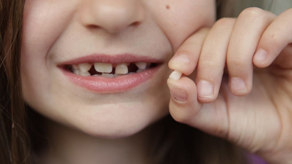 An inconvenient tooth: warning for children’s teeth – Channel 4 News