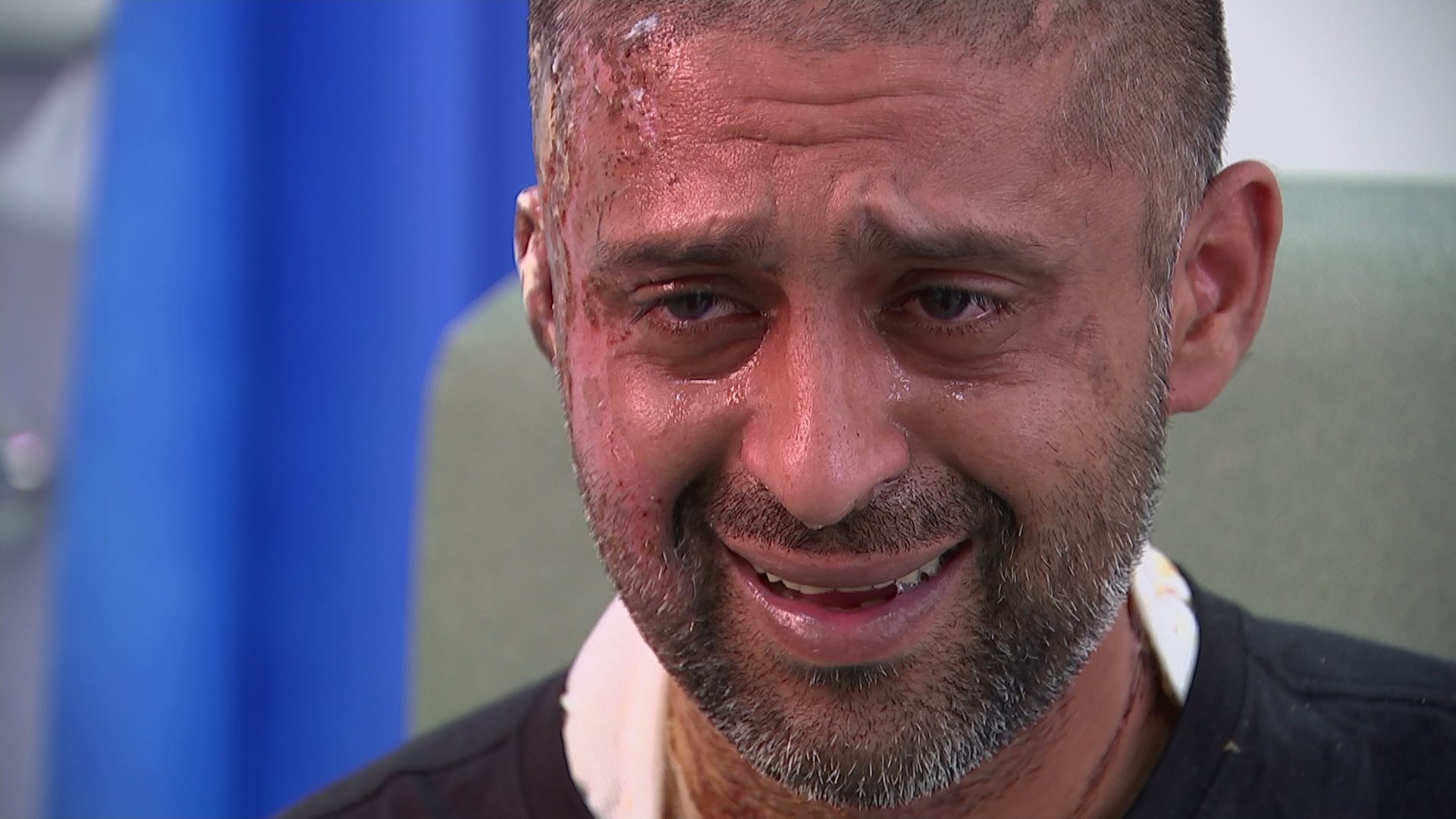 Police hunt acid attack suspect – Channel 4 News