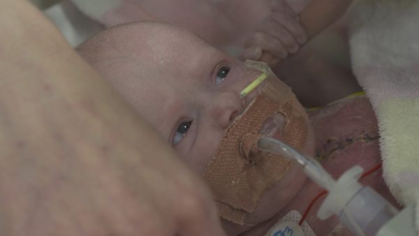 ‘Miracle’ baby survives after being born with heart outside body ...
