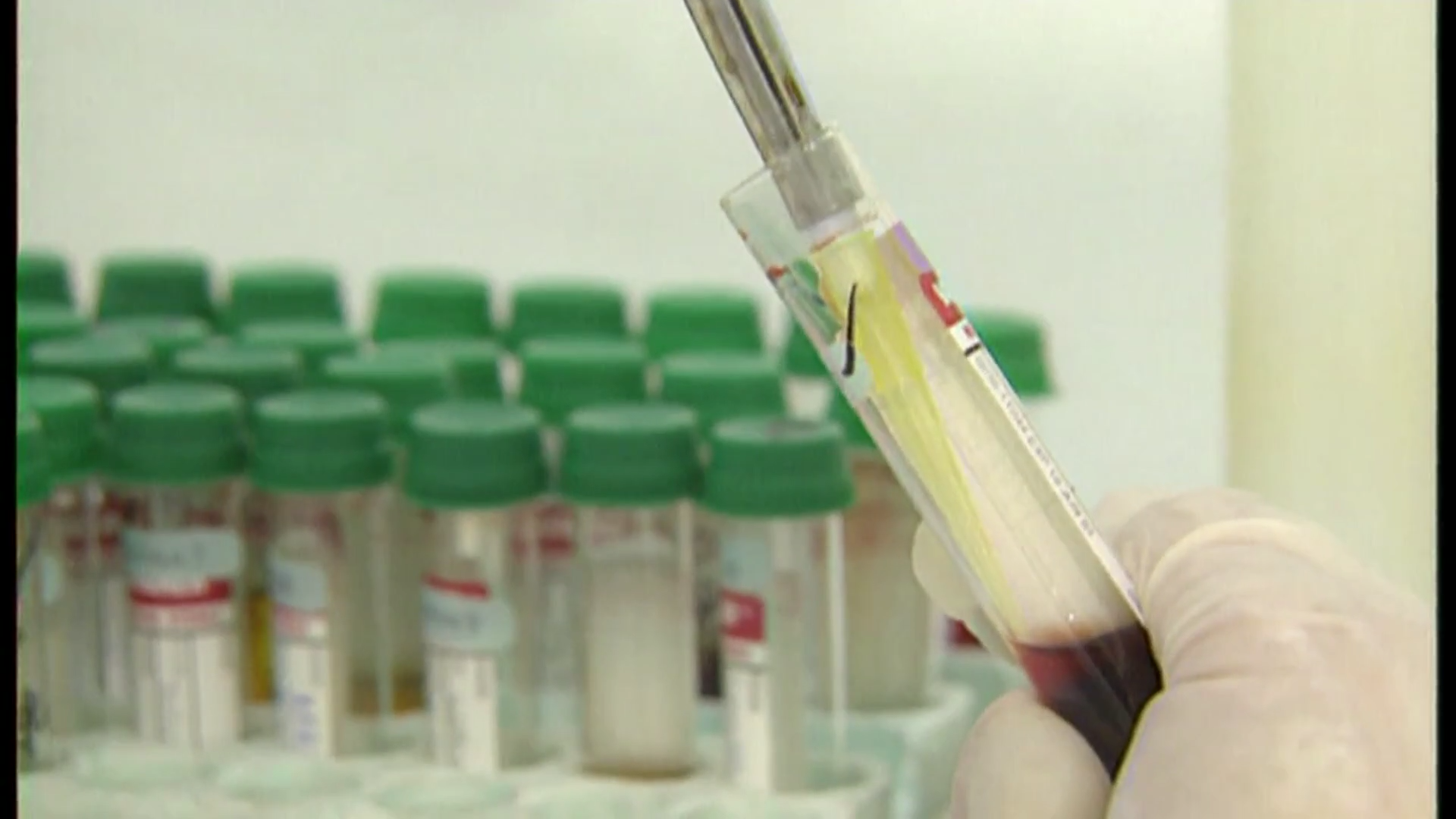 Inquiry into contaminated blood scandal hears harrowing testimony ...