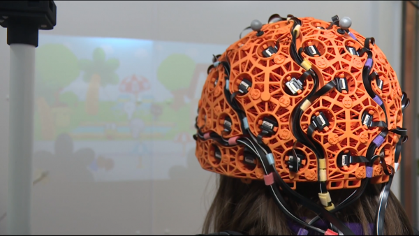 New brain scanner could revolutionise treatment of children with ...