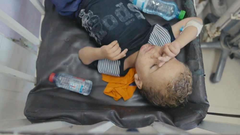 Dangerous skin diseases add to the turmoil of war for children in Gaza ...
