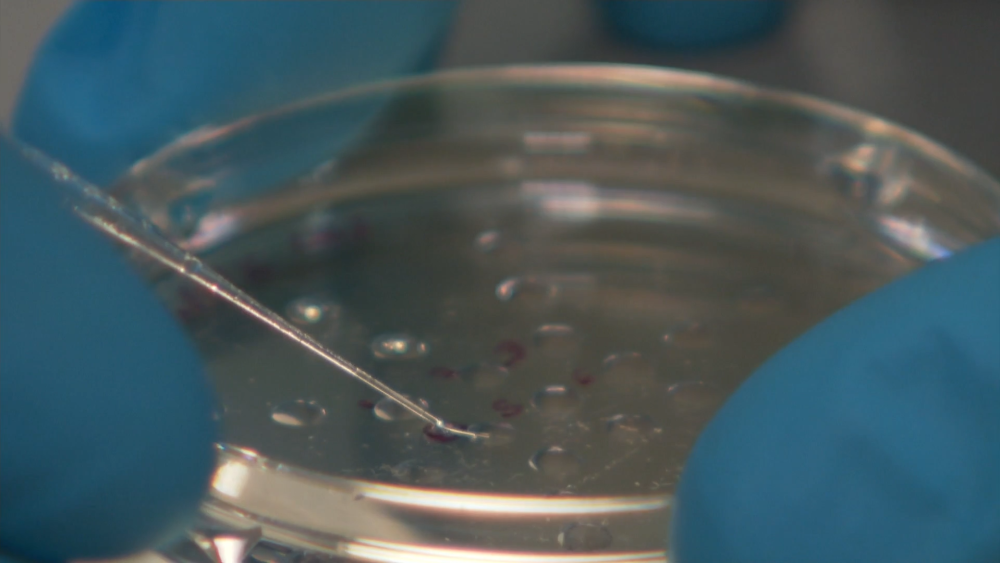 Lab-made ‘mirror bacteria’ risks life on Earth, scientists warn ...